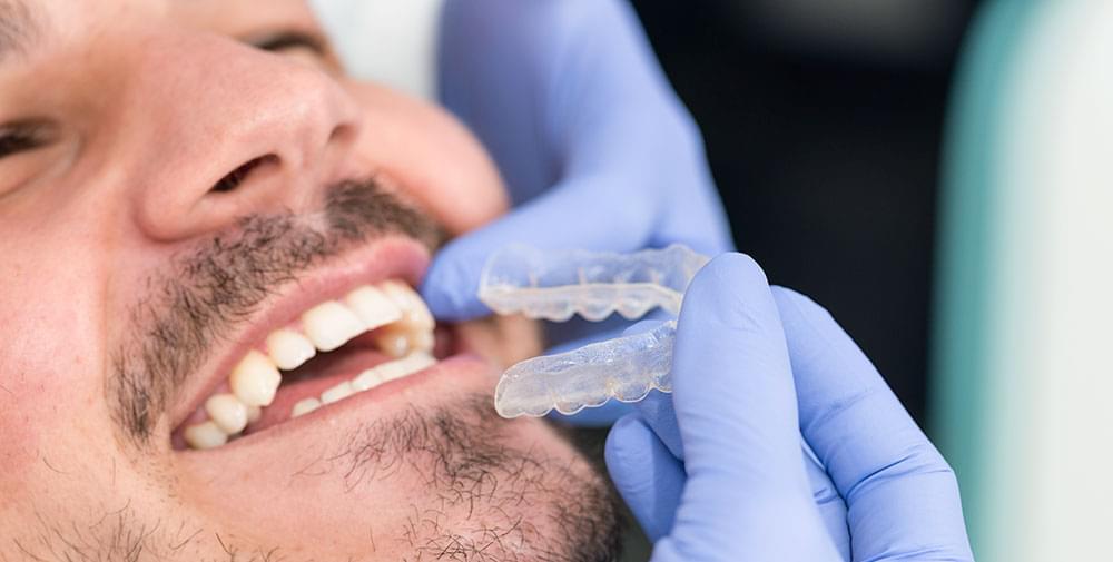 Common Causes of and Treatment for Crooked Teeth